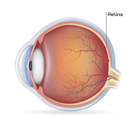 Patient Education Blue Coast Retina