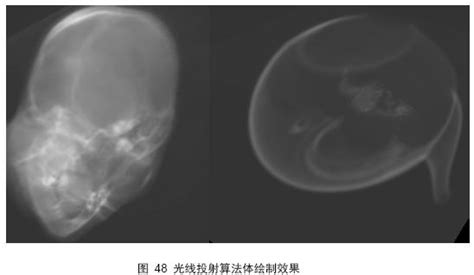 体绘制（volume Rendering）概述 Csdn博客