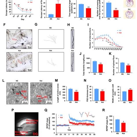 The Hippocampal Trisynaptic Circuit Based On Extensive Anatomical And