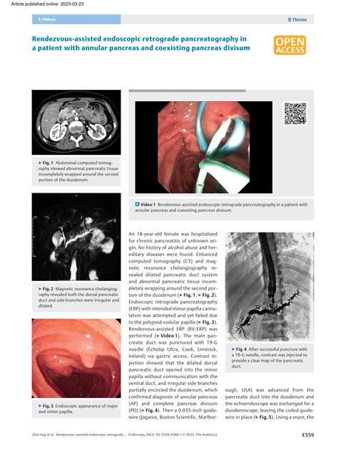 PDF Rendezvous Assisted Endoscopic Retrograde Pancreatography In A