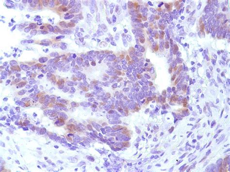 Cyclin E1 Sp146 Discovery Sci