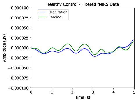 Comparison Of Band Passed Eeg Ecg And Fnirs Signals Of Healthy Download Scientific Diagram