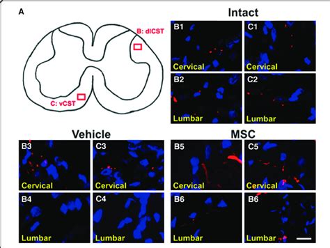 The Dorsal Corticospinal Tract Dlcst And Ventral Corticospinal Tract Download Scientific