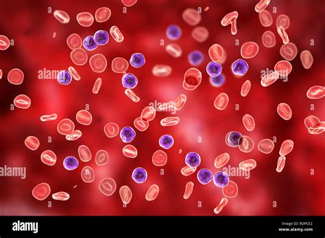 Acute Lymphoblastic Leukaemia Computer Illustration Showing Abundant