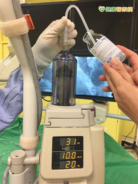 顯影劑使用量越大 腎損傷風險越高 健康醫療網 健康養生新聞資訊網路媒體