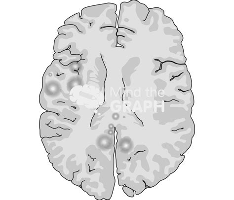 Brain Activation After Training Orbitofrontal Cortex