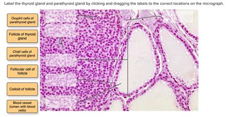 Solved Label The Thyroid Gland And Parathyroid Gland By Clicking And