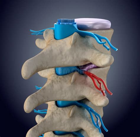 Dolor De La Médula Espinal Ilustraciones Stock Vectores Y Clipart