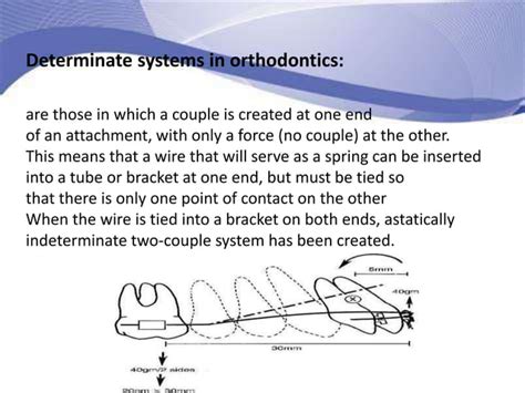 Determinate Vs Indeterminate Force Systems Pptx