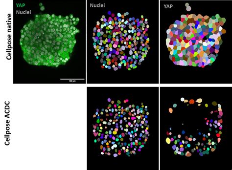Segmentation Of Multichannel Tiff Differ Between ACDC And Cellpose Issue SchmollerLab