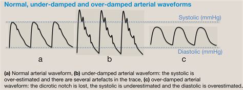 Processing Storage And Display Of Physiological Measurements