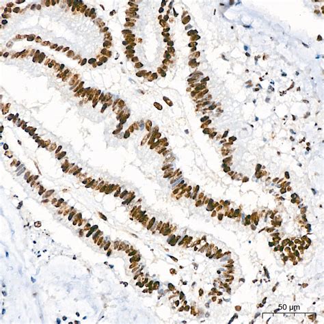 All T 세포 수용체 신호전달 경로 Antibodies Research Areas Abclonal