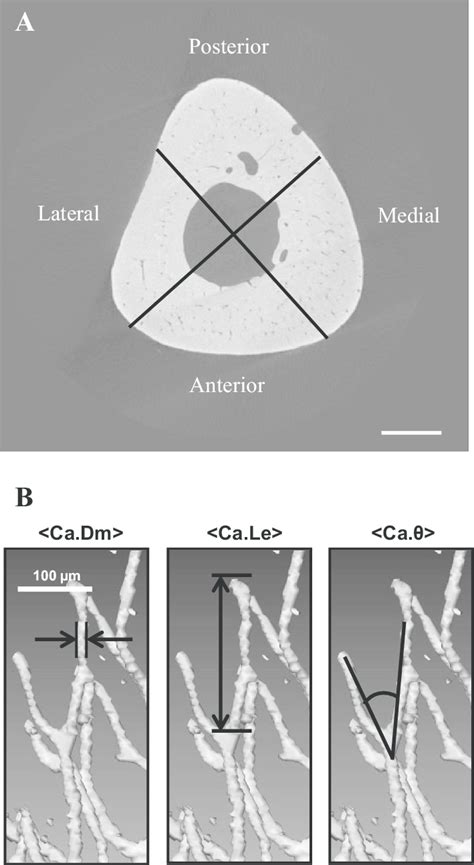 A Reconstructed Image Of A 12 Wk Tibial Transverse Section The Image Download Scientific