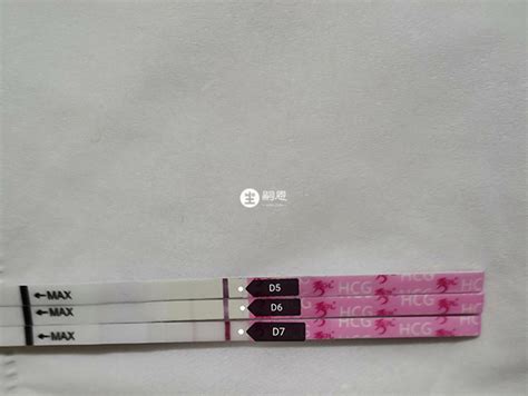 Hcg