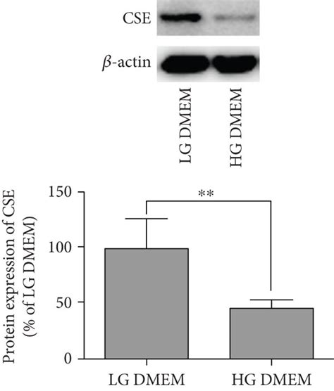effects of high glucose on the expression of cse 3 mst and cbs in