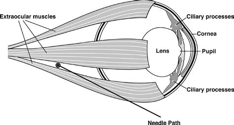 Development Of Retrobulbar And Auriculopalpebral Nerve Blocks In California Sea Lions Zalophus