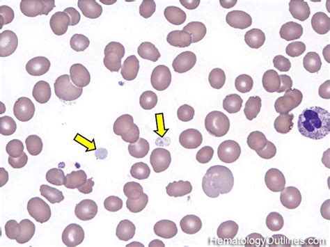 Hypogranular Platelet Atlas Biological Science Picture Directory