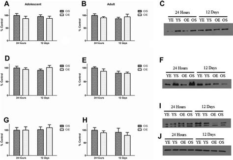 Cortical Nmda Receptor Subunit Expression Nr1 Expression In A