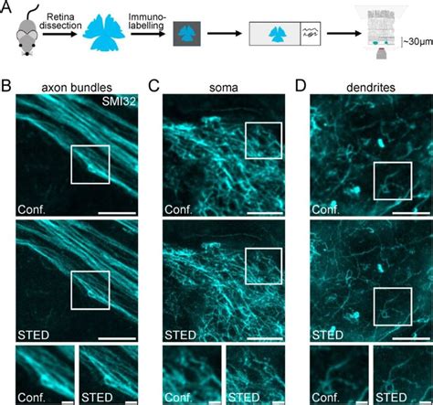 Nikon Instruments On Linkedin Superresolution Sted Microscopy