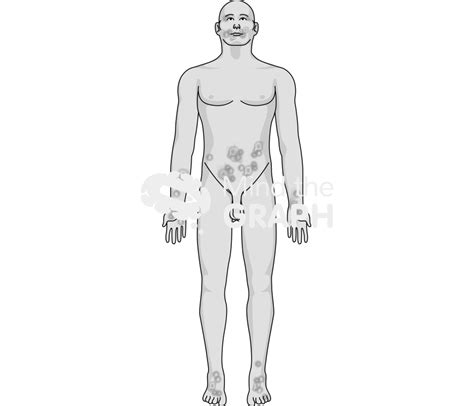 Free Man Erythema Multiforme Icons Symbols Pictures And Images Mind The Graph