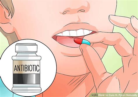 5 Ways To Cure H Pylori Naturally Wikihow