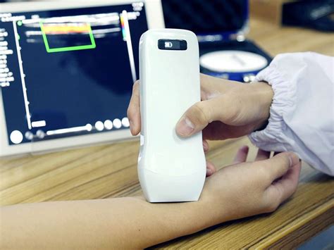 Buy Wireless Ultrasound Probe Used In Vascular From Beijing Konted Medical Technology Co Ltd