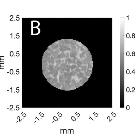 The Same Axial Slices Acquired Using An Epi Sequence Where The Number