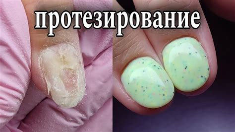 Протезирование ногтя😨 часть 3👌🏻 маникюр красивыйманикюр ногти Youtube