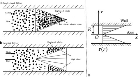 Schematic Drawings Of Traditional And Reverse Placements Of Vcf I A