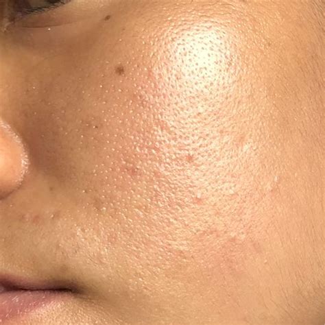 Buy Premium Skin Care Products Online The Pink Foundry Tpf