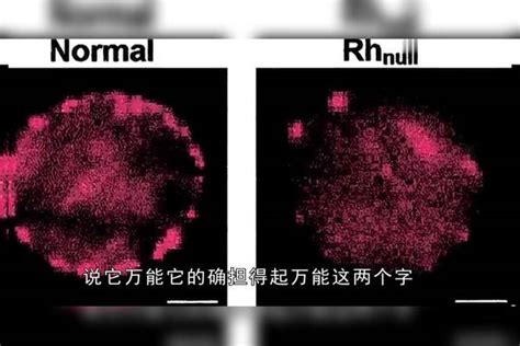 超极罕见的黄金血液全世界不足50个比熊猫血更稀有 血液 全世界 黄金