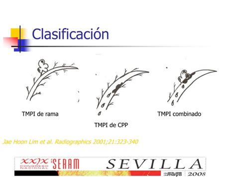 PPT - TUMOR MUCINOSO PAPILAR INTRADUCTAL PowerPoint Presentation, free download - ID:3735316