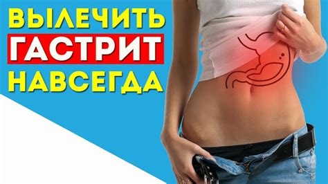 КАК вылечить ГАСТРИТ Лечение хронического гастрита в домашних условиях