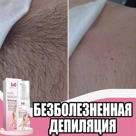 Крем для депиляции для чувствительной кожи подходит для интимных зон безболезненное удаление