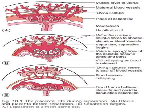 Post Partum Hemorrhage Pphppt