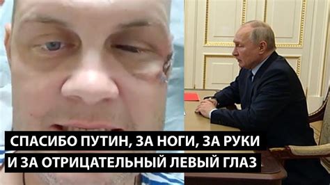 Спасибо путин За сломанные руки ноги и за отрицательный левый глаз