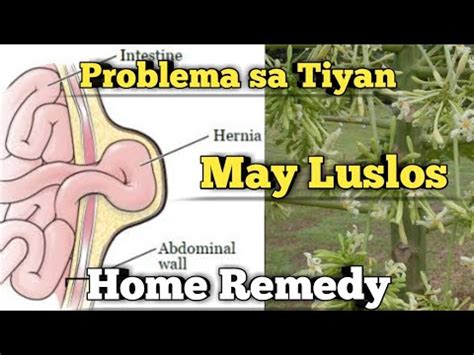 Saan Nakukuha Ang Luslos Ng Lalaki