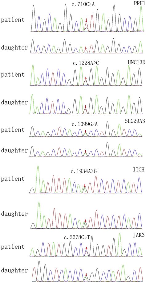 Confirmation Of Gene Mutations Using Sanger Sequencing The Same Gene