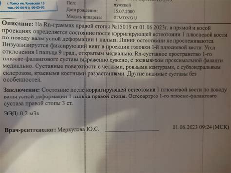 Вальгусная деформация стопы Hallux Valgus Medaboutme