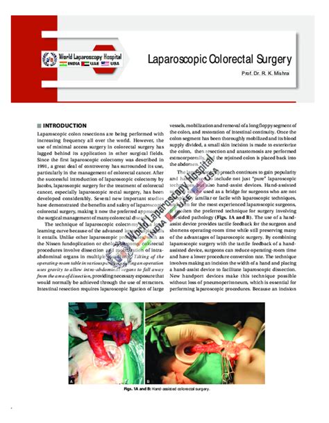 Pdf Laparoscopic Colorectal Surgery