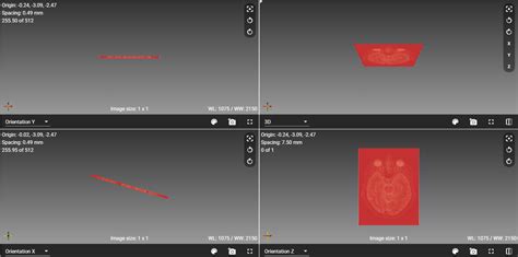Orientation Of Slices In The 2d Views · Issue 463 · Kitwareglance