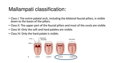Ppt Anatomy Of Respiratory Tract And Airway Assessment Powerpoint