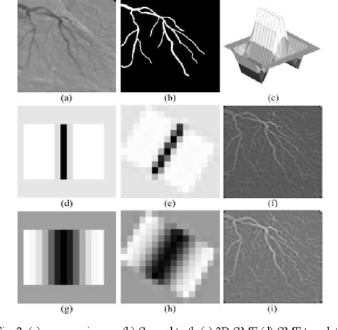 Figure 2 From An Enhanced Convolutional Neural Network Based On L1 Regularization For