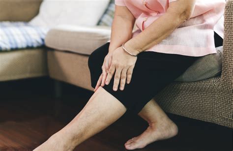 What Does Knee Osteoarthritis Feel Like Chris Bailey Orthopaedics