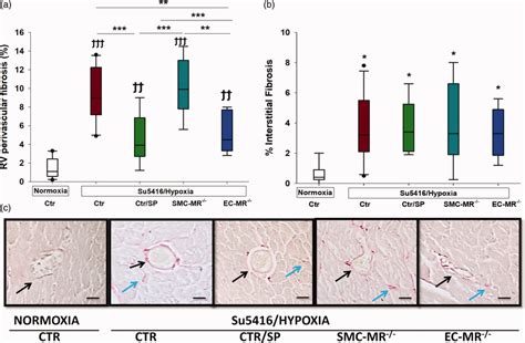 Effects Of MR On Right Ventricular Fibrosis RV Fibrosis Was Evaluated Download Scientific