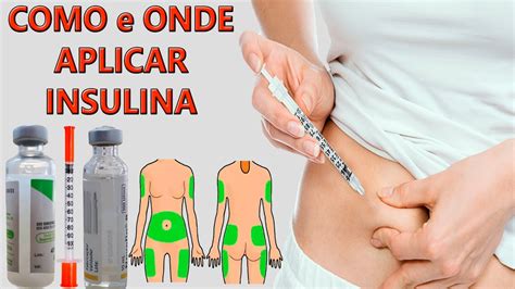 Como Aplicar Insulina Com Frasco E Seringa Youtube
