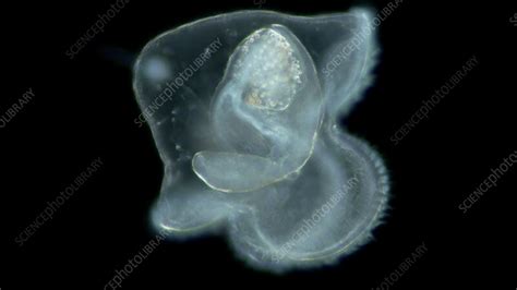 Ribbon Worm Larva Light Microscopy Stock Video Clip K0140935