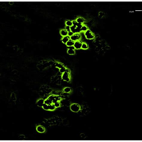 20 × Image Of S2 Cells Transfected With Gfp Expression Construct