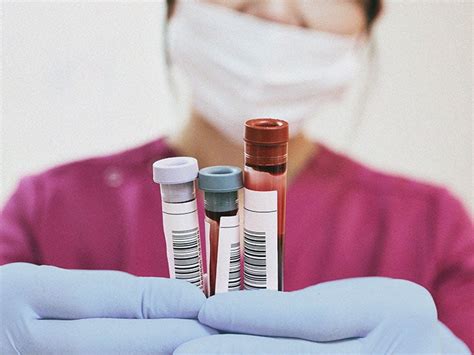 Testing Uric Acid At Home