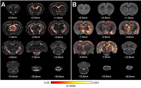 Imaging Research Tbi Howard University RCMI